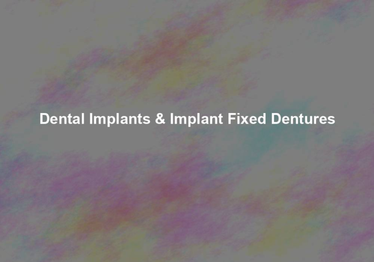 Dental Implants & Implant Fixed Dentures - $399 Dental Implants