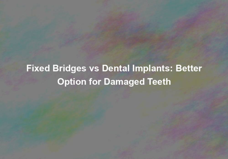 Fixed Bridges vs Dental Implants: Better Option for Damaged Teeth ...