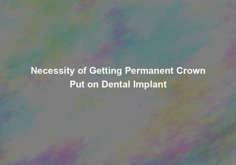 Necessity of Getting Permanent Crown Put on Dental Implant - $399 ...