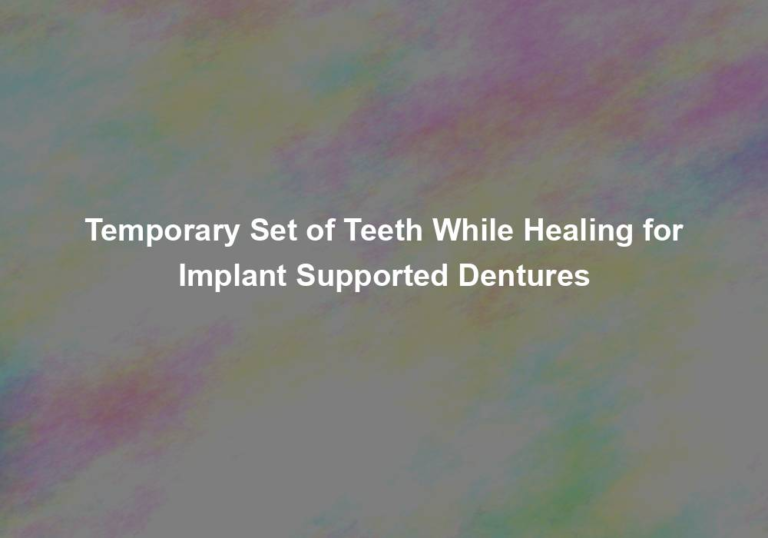 Temporary Set of Teeth While Healing for Implant Supported Dentures ...